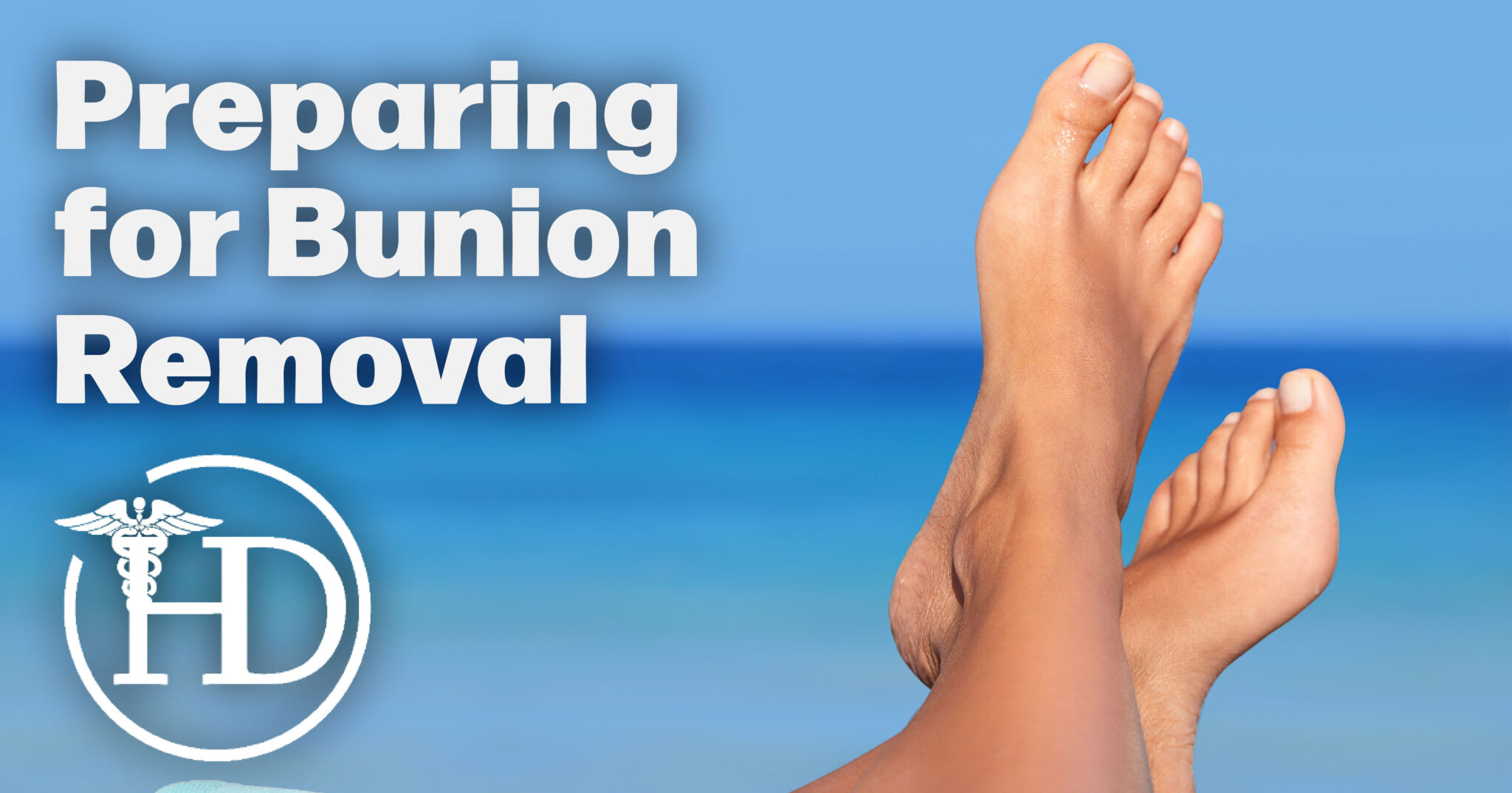 Preparing for a Successful Bunion Removal Surgery: A Comprehensive ...